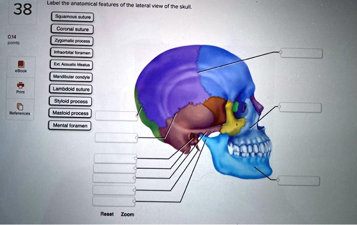 38 Label the anatomical features of the lateral view of the skull ...
