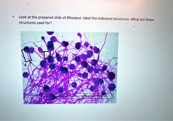 SOLVED: Look at the prepared slide of Rhizopus- label the indicated ...