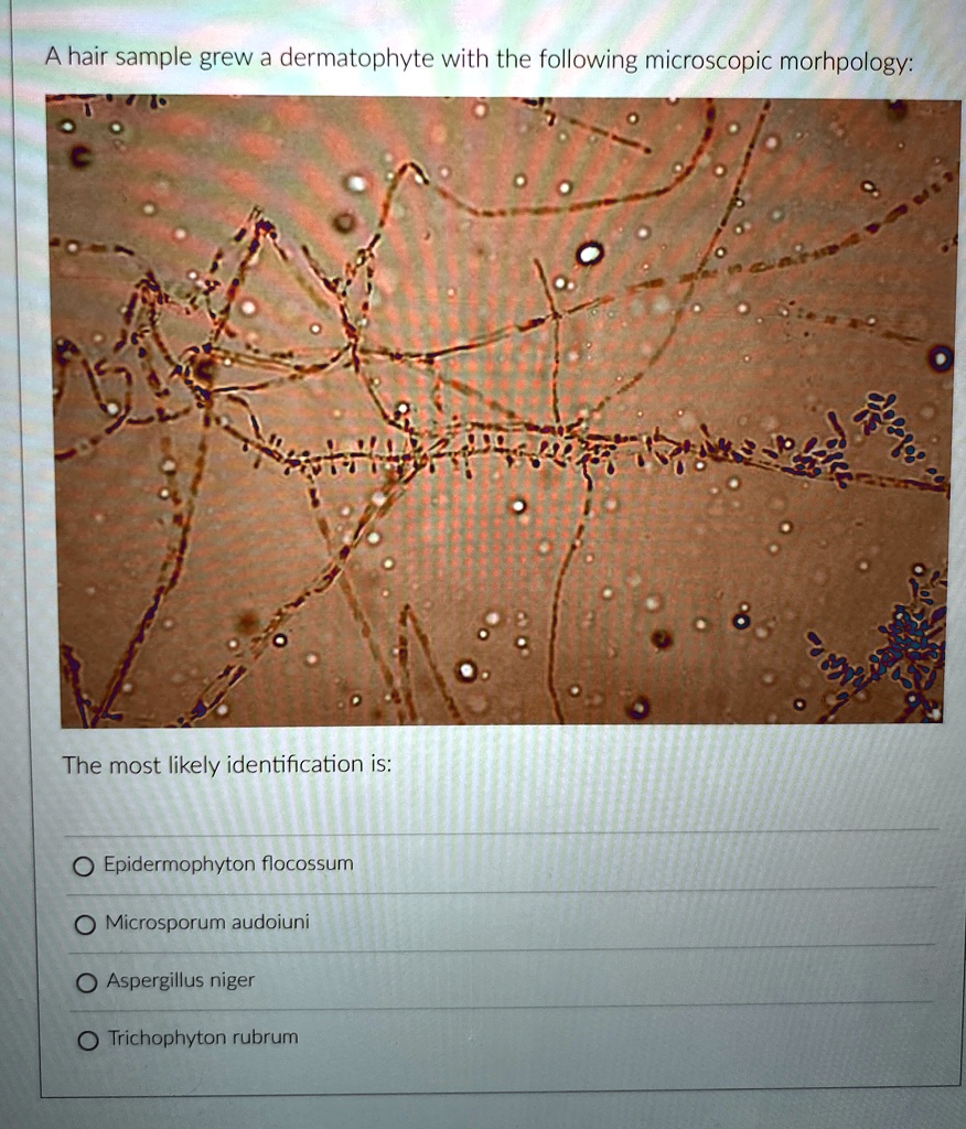 A hair sample grew a dermatophyte with the following microscopic ...