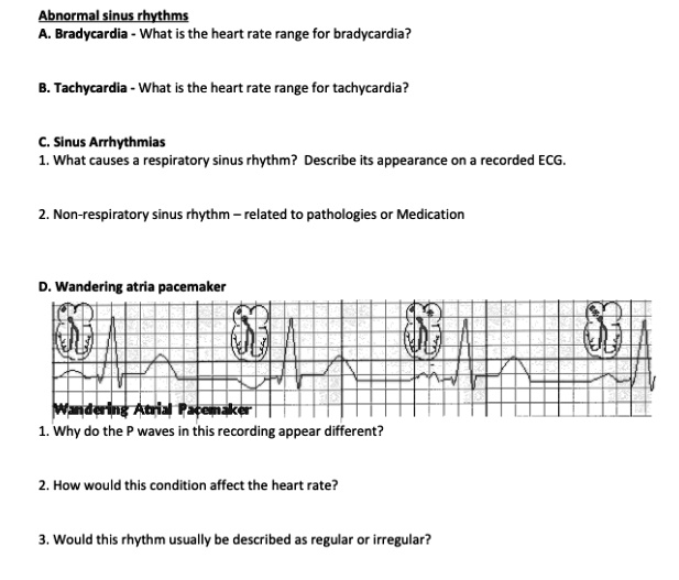 abnormal sinus rhythms abradycardia what is the heart rate range for ...