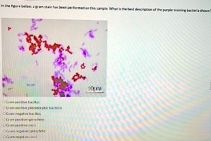 In the figure below, a gram stain has been performed on this sample. What is the best ...