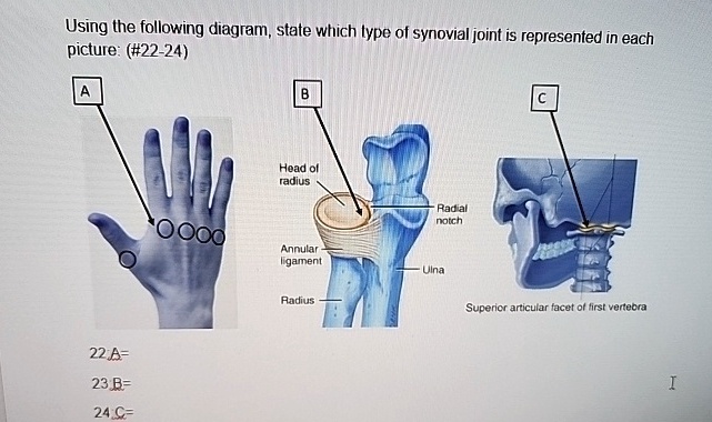 using the following diagram state which type of synovial joint is ...