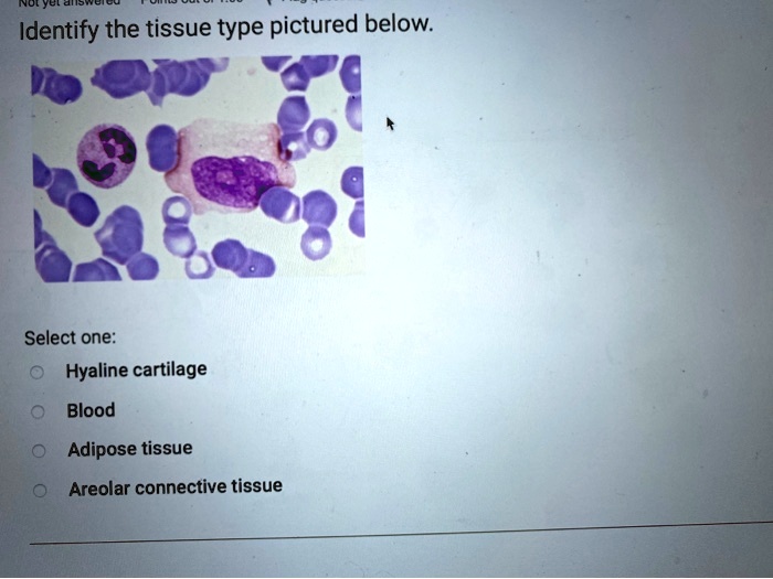 noi identify the tissue type pictured below select one hyaline ...