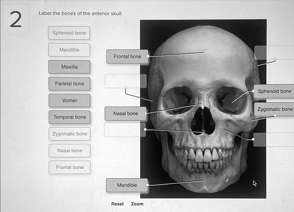 2 Label the bones of the anterior skull. Sphenoid bone Mandible Maxilla ...
