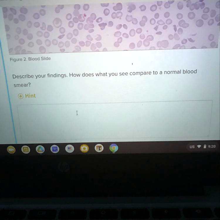 SOLVED: '( Biomedical Science ) Figure 2 Blood Slide Describe your ...