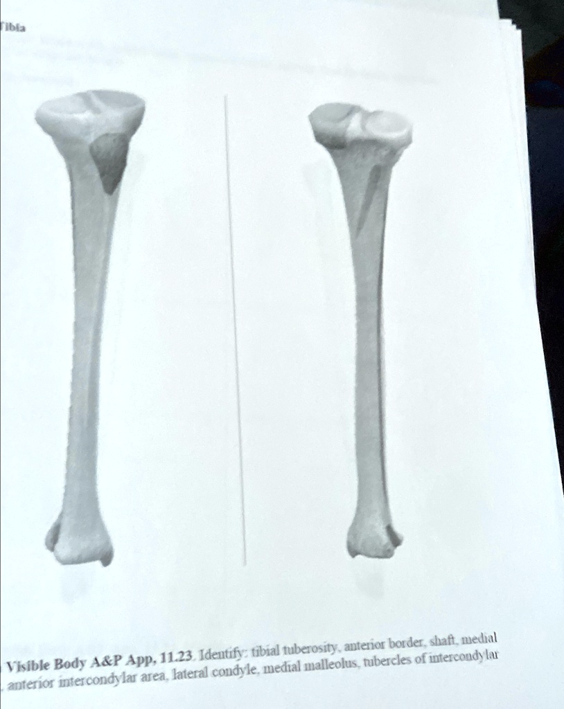 Fibula Visible Body A P App, 11.23. Identify: tibial tuberosity ...