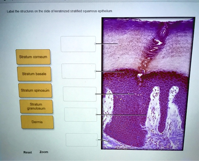 label the structures on the slide of keratinized stratified squamous ...