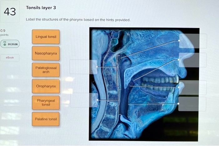 SOLVED: Tonsils layer 3 43. Label the structures of the pharynx based ...