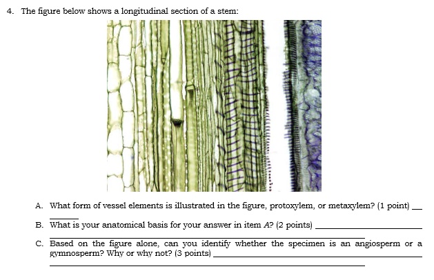 SOLVED:The figure below shows longitudinal section of stem: What form ...