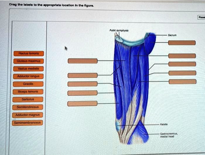 SOLVED: Drag the labels to the appropriate location in the figure ...
