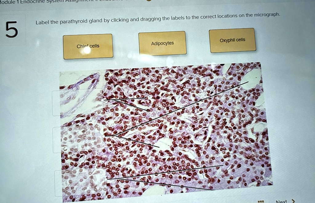 Module 1 Endocrine System 5 Label the parathyroid gland by clicking and ...