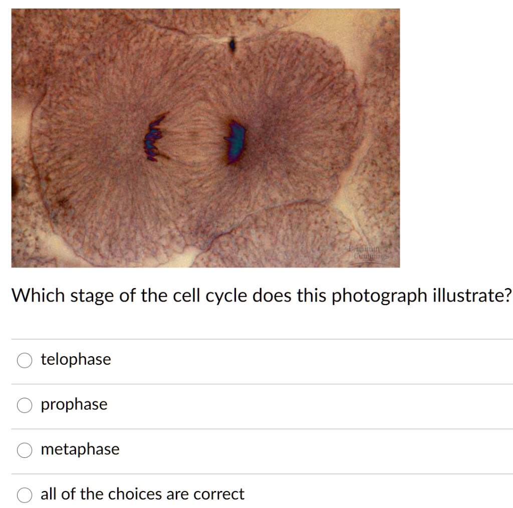 SOLVED: Which stage of the cell cycle does this photograph illustrate ...