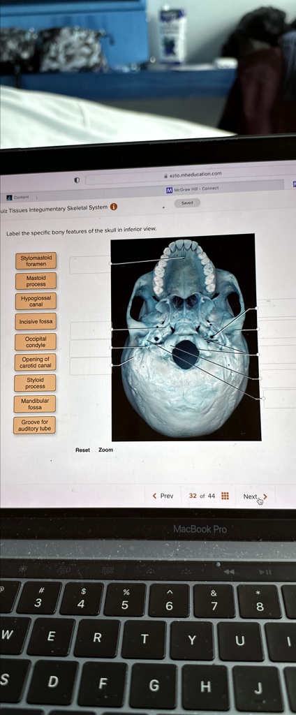 Label the specific bony features of the skull in inferior view ...