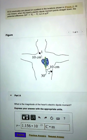 ecg electrodes are placed on a patient in the locations shown in figure ...