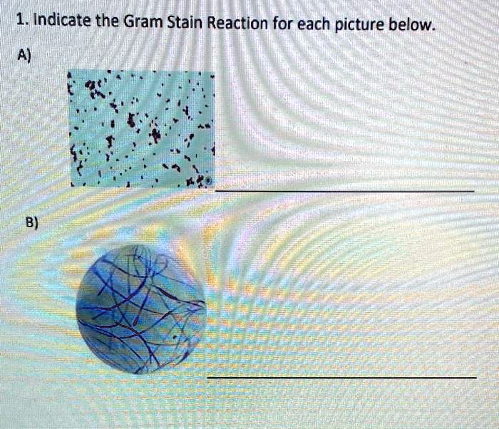 SOLVED:1. Indicate the Gram Stain Reaction for each picture below. A) 8)