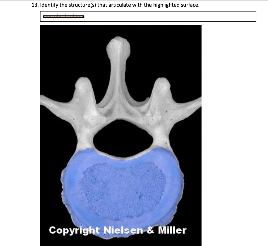 This is the lumbar vertebral body. Identify the structures that ...