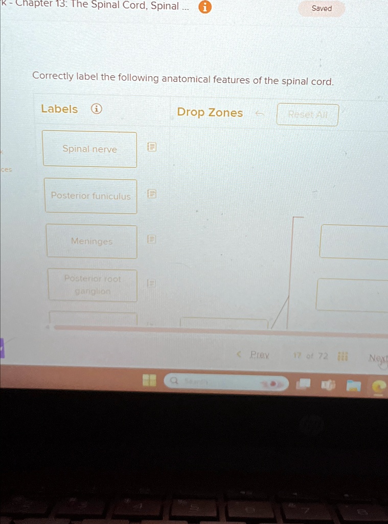 K - Chapter 13: The Spinal Cord, Spinal ... Correctly label the ...