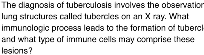 The diagnosis of tuberculosis involves the observation lung structures ...
