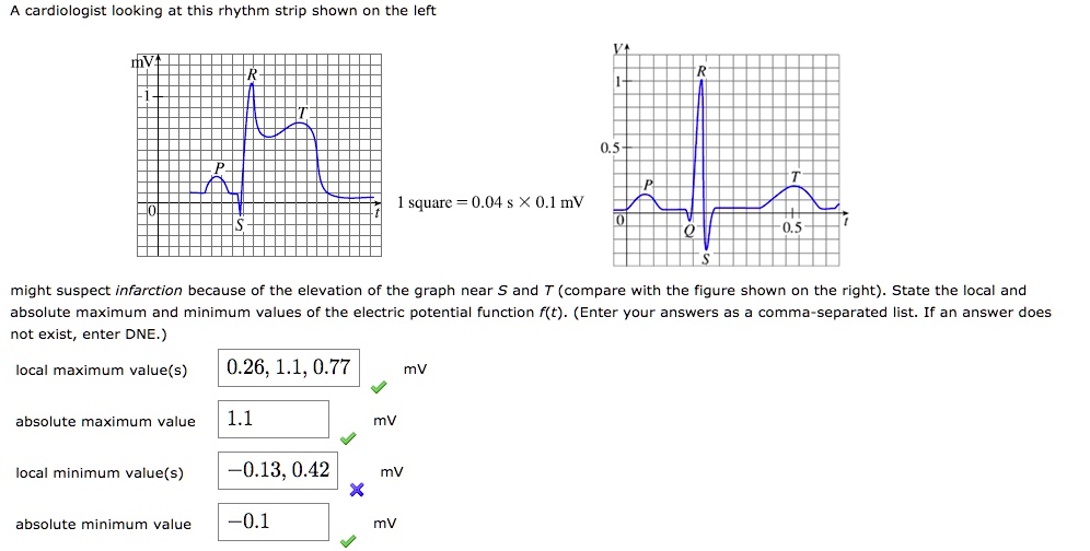 SOLVED: Cardiologists looking at this rhythm strip shown on the left ...