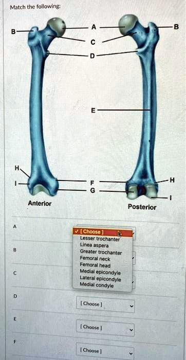 SOLVED: Match the following: Anterior Posterior A V Lesser trochanter ...