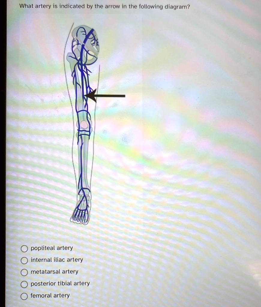 What artery is indicated by the arrow in the following diagram ...