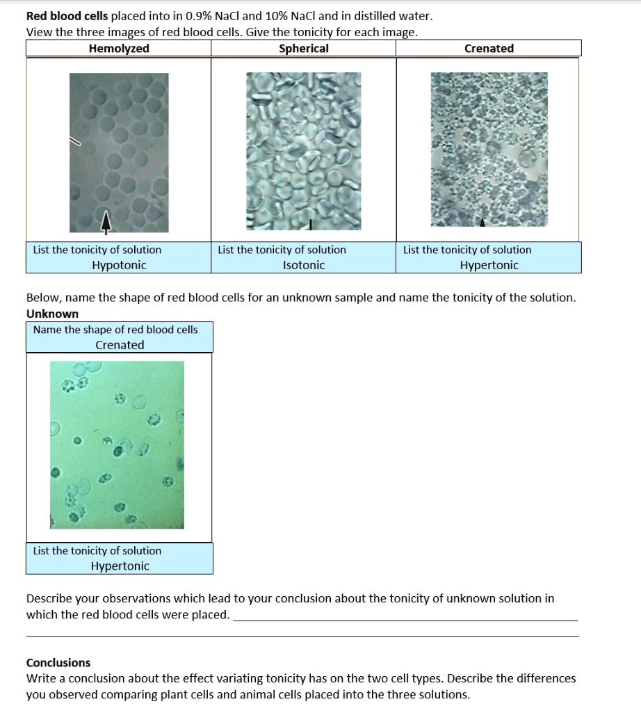 red blood cells placed into in 09 nacl and 10 nacl and in distilled ...