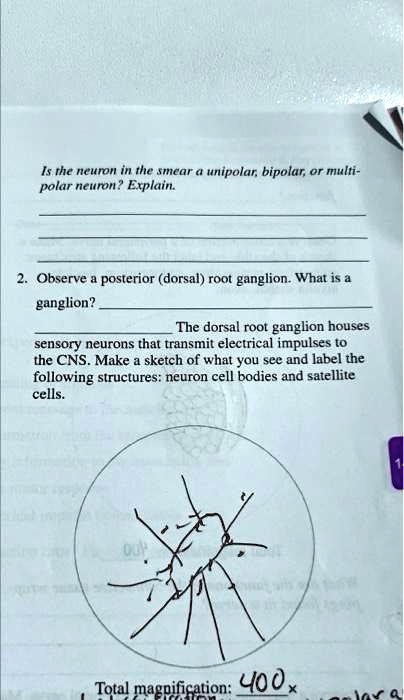 Is the neuron in the smear a unipolar, bipolar, or multi- polar neuron ...