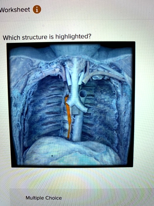 SOLVED: Worksheet Which structure is highlighted? Multiple Choice