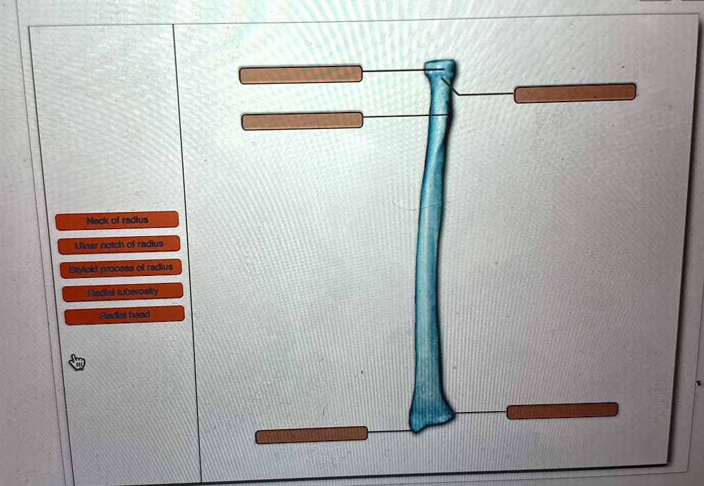 neck of radius ulnar notch of radius styloid process of radius radial ...