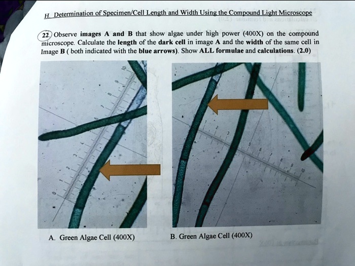 VIDEO solution: Determination of Specimen/Cell Length and Width Using ...