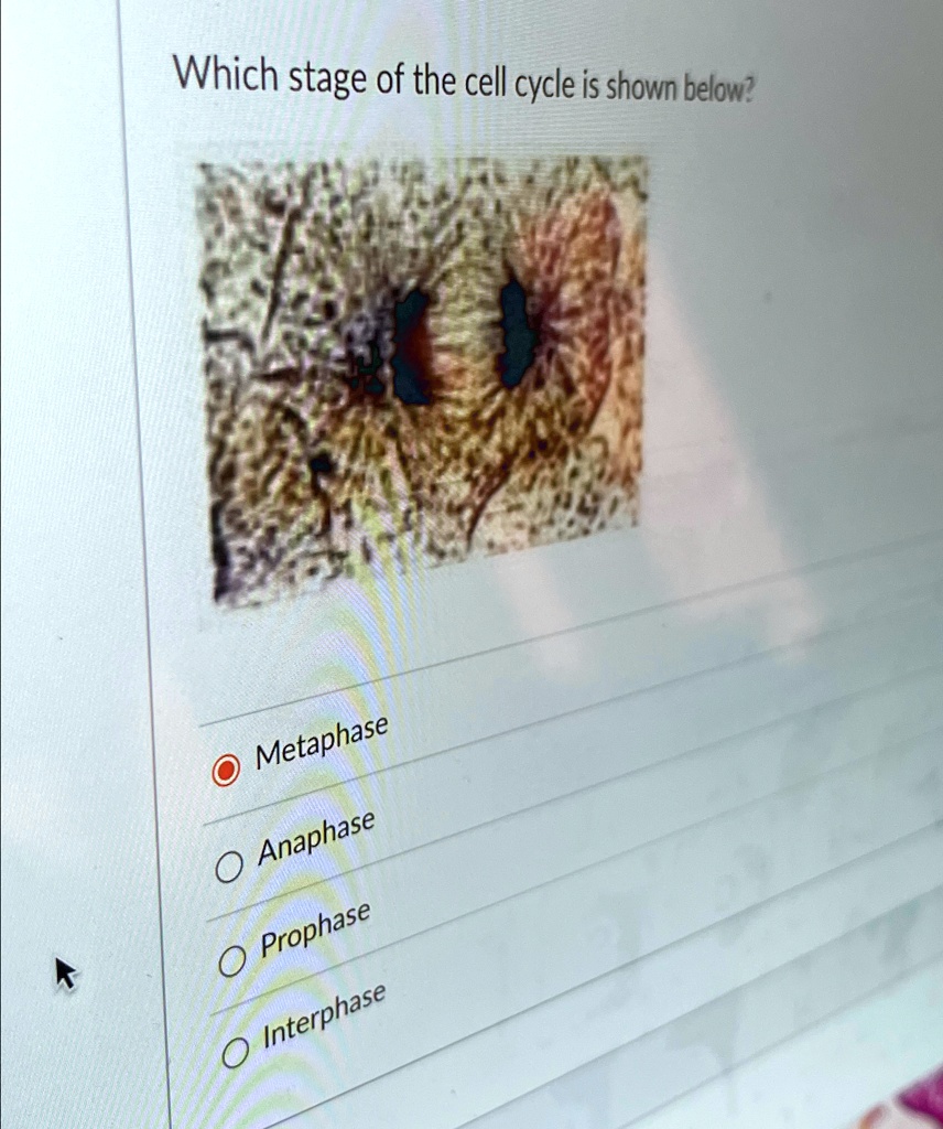 Which stage of the cell cycle is shown below? Metaphase Anaphase ...