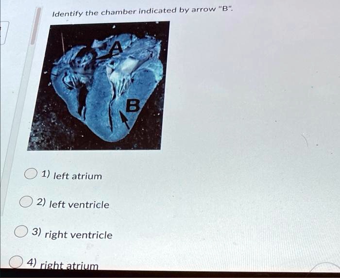 SOLVED: Identify the chamber indicated by arrow "B" 1) left atrium 2 ...
