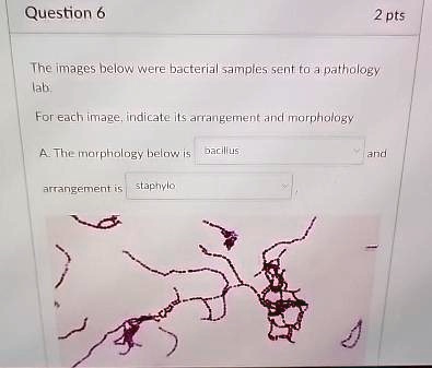 The images below were bacterial samples sent to a pathology lab: For ...