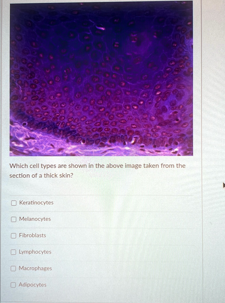 which cell types are shown in the above image taken from the section of ...