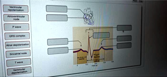 Ventricular repolarization Atrioventricular node P wave QRS complex ...