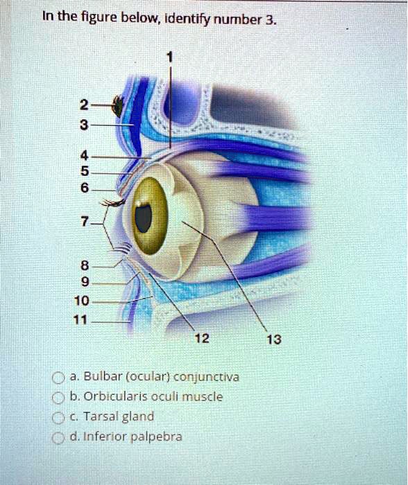 SOLVED: In the figure below; identify number 3 6 9 10 11 12 13 a ...