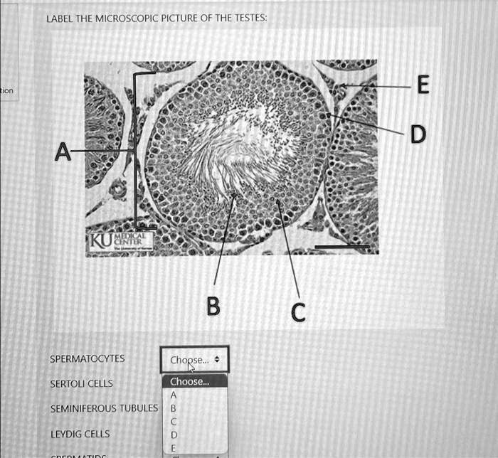 SOLVED: LABEL THE MICROSCOPIC PICTURE OF THE TESTES 207709 E tion D A ...