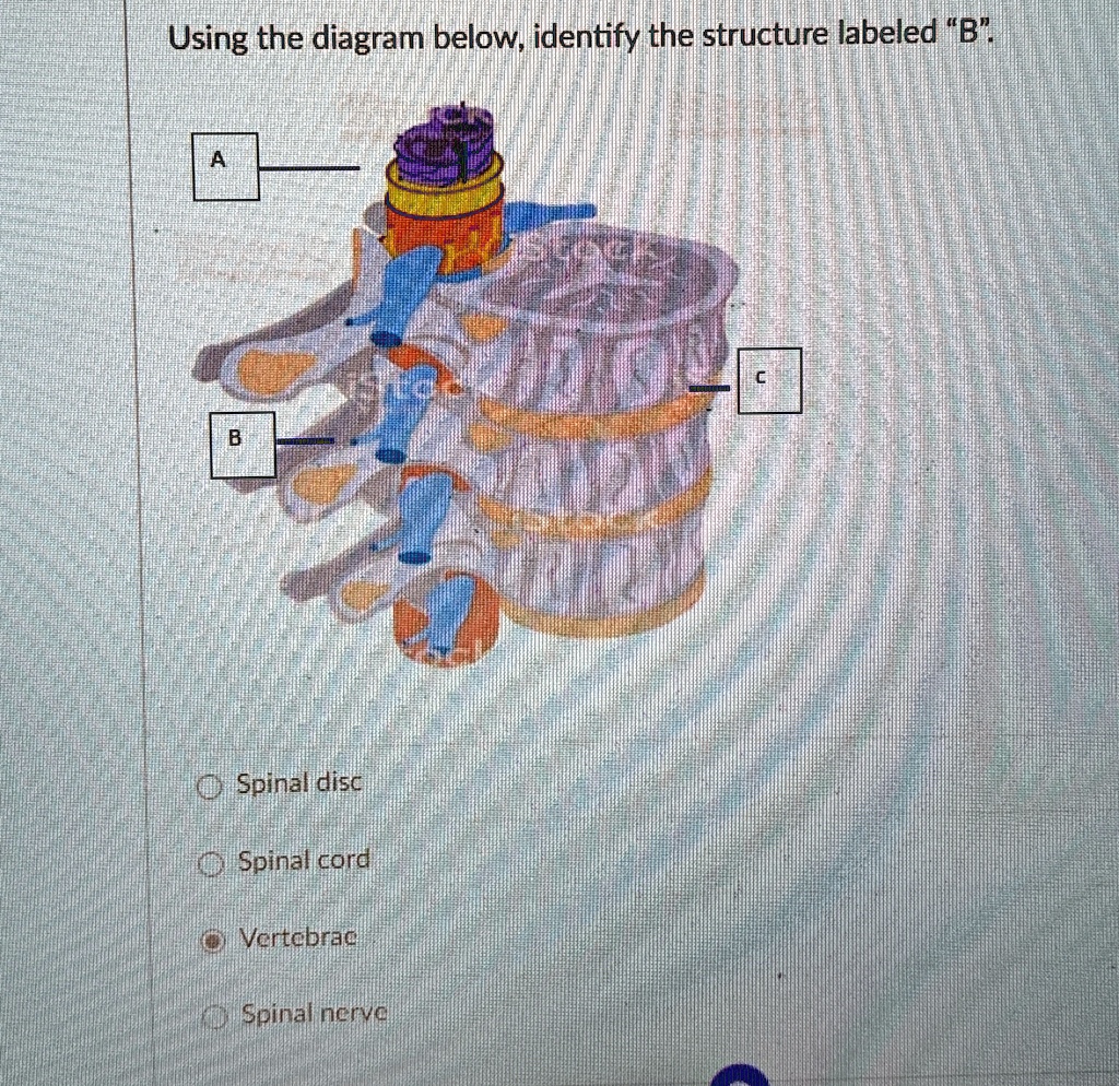 Using the diagram below, identify the structure labeled "B". A B Spinal disc Spinal cord ...