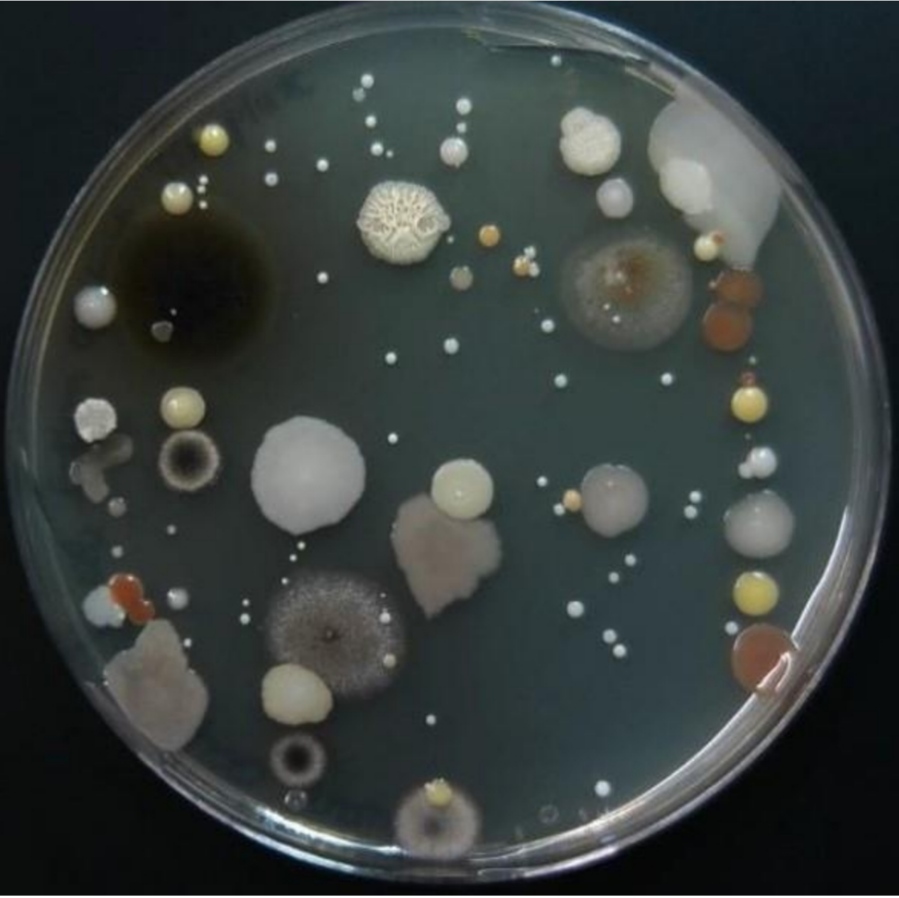 Fully Characterize Each Different Isolated Colonies In The Illustration