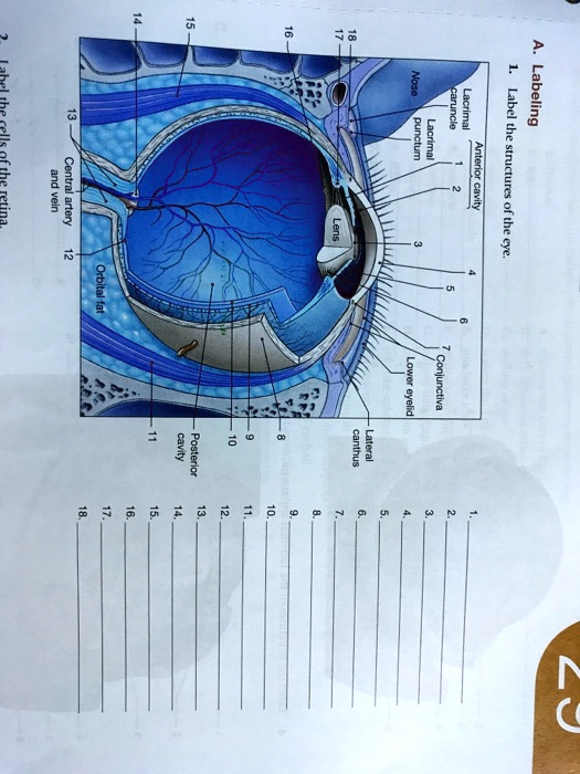 SOLVED: Vose A. Labeling caruncle, Lacrimal punctum, Lacrimal Anterior ...
