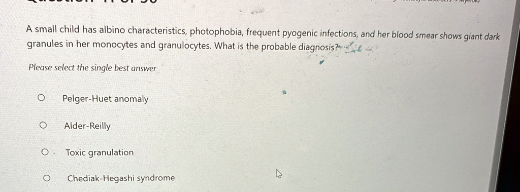 a small child has albino characteristics photophobia frequent pyogenic ...