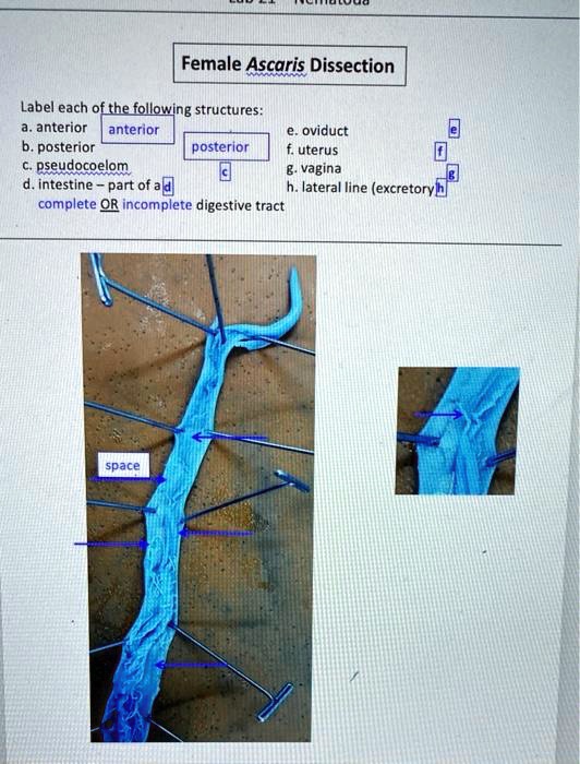 SOLVED: can you label this please? thank you! Female Ascaris Dissection ...