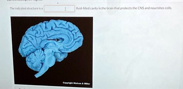 The indicated structure is a fluid-filled cavity in the brain that ...