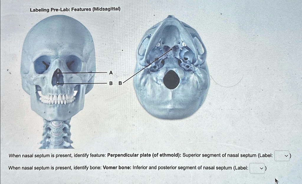 Labeling Pre-Lab: Features (Midsagittal) A B B When nasal septum is ...