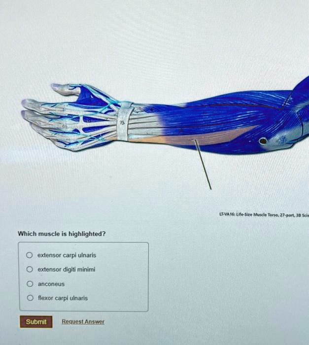 Which muscle is highlighted? ? extensor carpi ulnaris ? extensor digiti ...