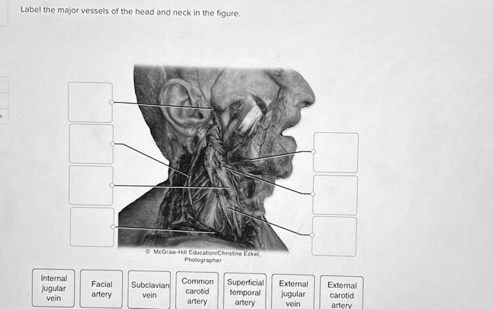 Label the major vessels of the head and neck in the figure. McGraw-Hill ...