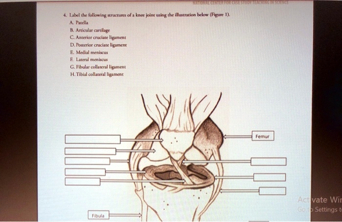SOLVED: Label the following structures: A. Patella B. Articular ...