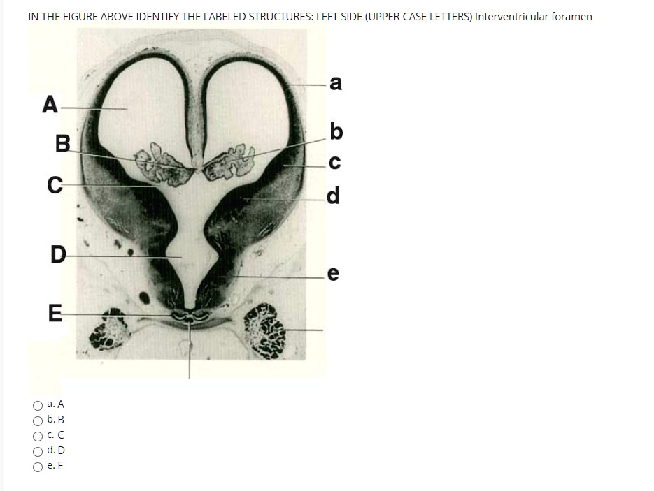 SOLVED: IN THE FIGURE ABOVE IDENTIFY THE LABELED STRUCTURES: LEFT SIDE ...