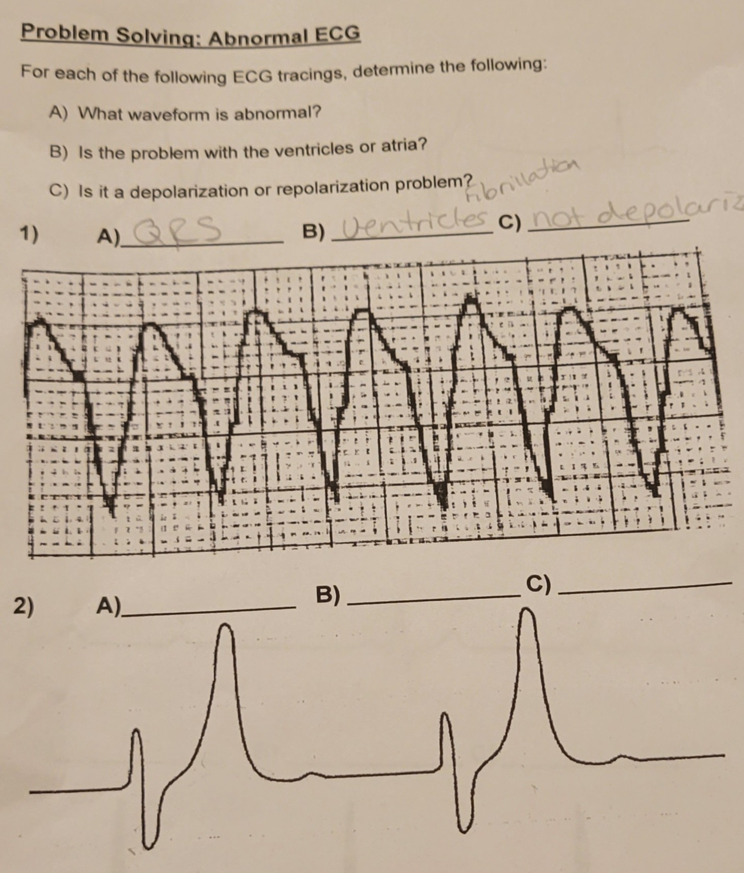SOLVED: Problem Solving: Abnormal ECG For each of the following ECG ...