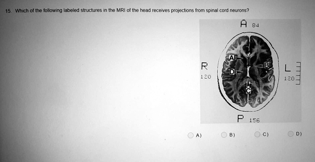 [GET ANSWER] 15. Which of the following labeled structures in the MRI ...